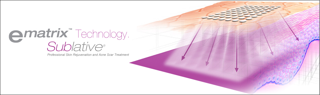 eMatrix™ Sublative™ – City LaserClinic